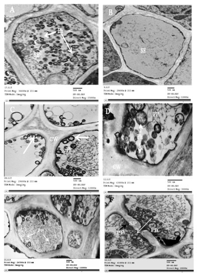 Plants | Free Full-Text | Effect of Phytoplasma Associated with Sesame ...