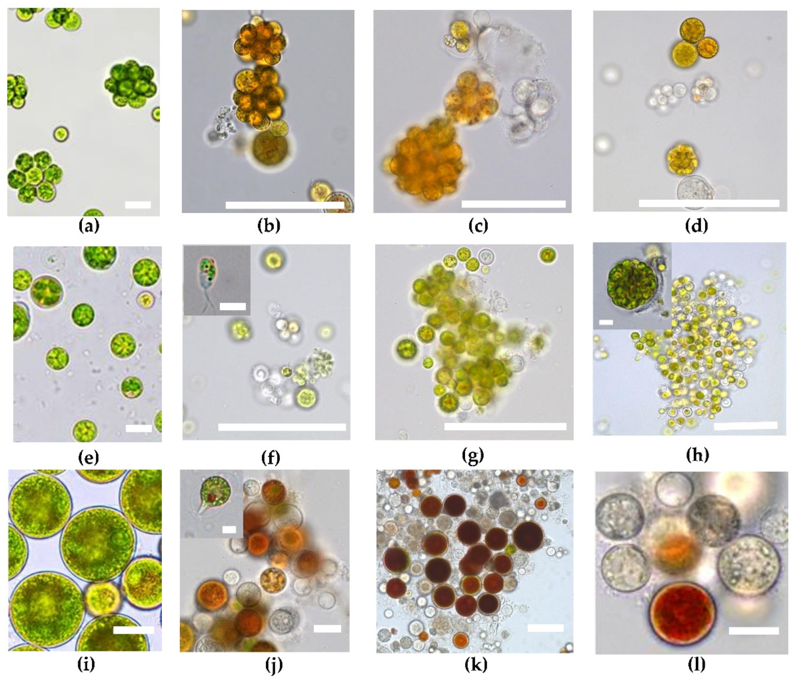 Differential Responses to UV-A Stress Recorded in Carotenogenic ...