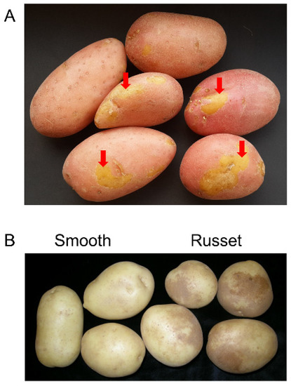 Potato Periderm Development and Tuber Skin Quality