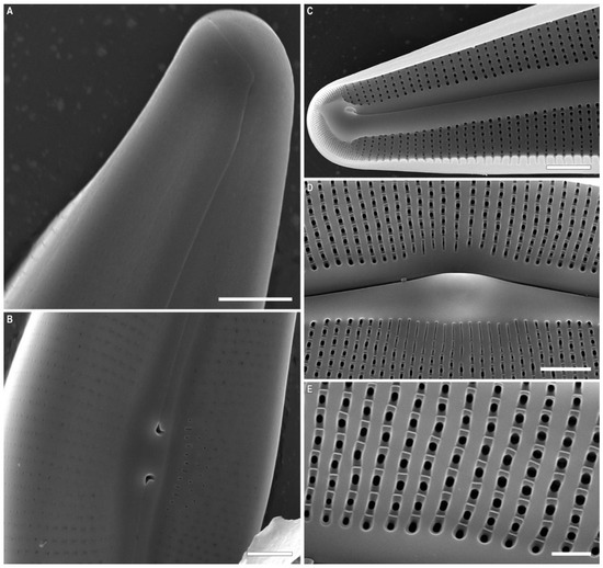 Molecular and Morphological Investigations of Two Giant Diatom Cymbella ...