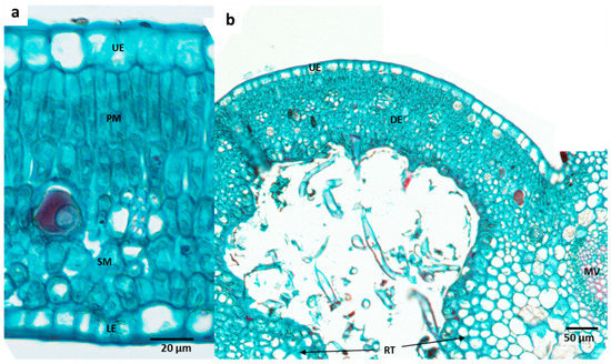 A Comparative Study of the Anatomy of Leaf Domatia in Gardenia ...
