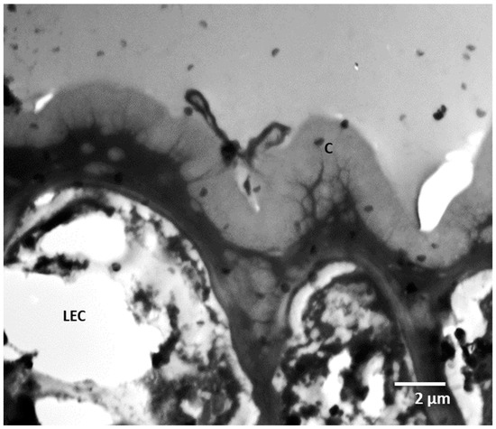 A Comparative Study of the Anatomy of Leaf Domatia in Gardenia ...