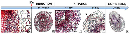 Transcriptome Dynamics of Rooting Zone and Leaves during In Vitro ...