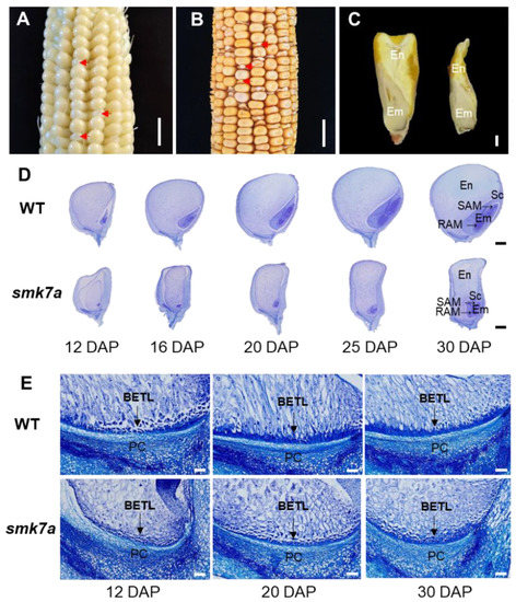 Characterization and Transcriptome Analysis of Maize Small-Kernel Mutant smk7a in Different ...