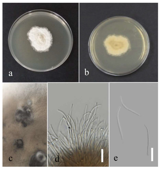 Taxonomic Advances from Fungal Flora Associated with Ferns and Fern ...