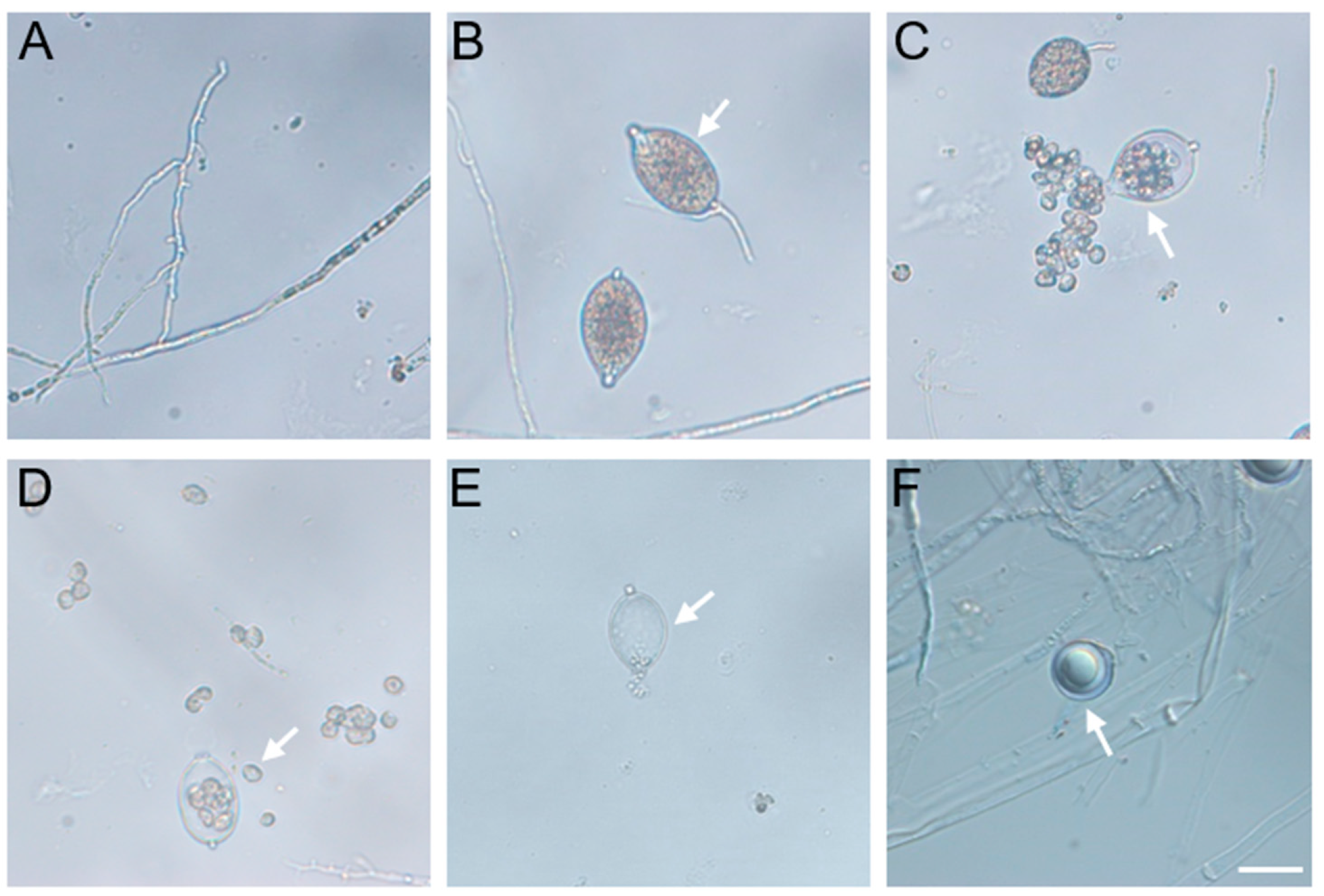 Sporangia Under Microscope