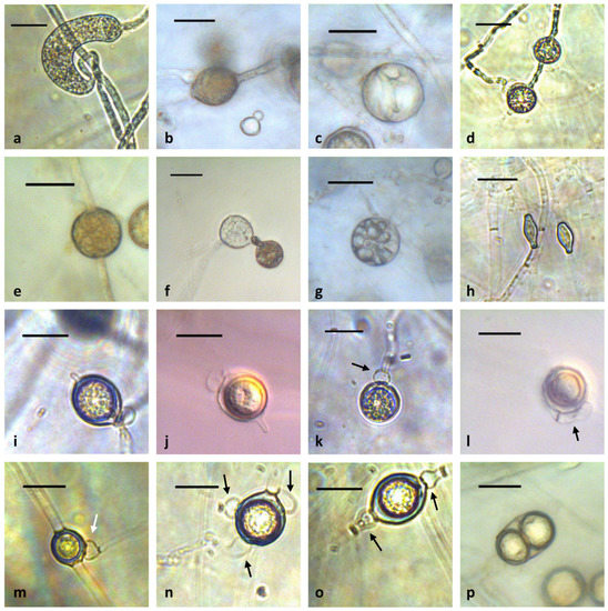 Globisporangium and Pythium Species Associated with Yield Decline of ...