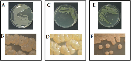 Chemical Identification of Secondary Metabolites from Rhizospheric ...