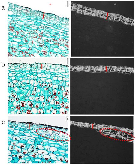 Epigenetic Modifications Related to Potato Skin Russeting