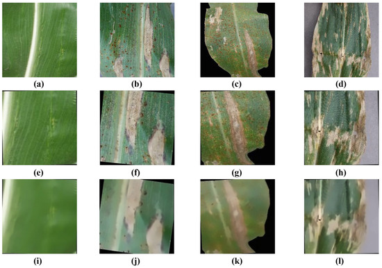 MTDL-EPDCLD: A Multi-Task Deep-Learning-Based System for Enhanced ...