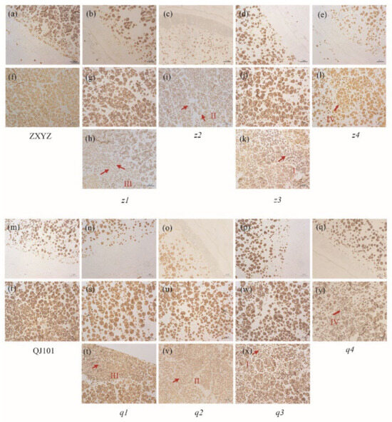 Starch Properties and Morphology of Eight Floury Endosperm Mutants in Rice