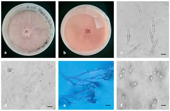 Diversity and Pathogenicity of Fusarium Species Associated with Stalk ...