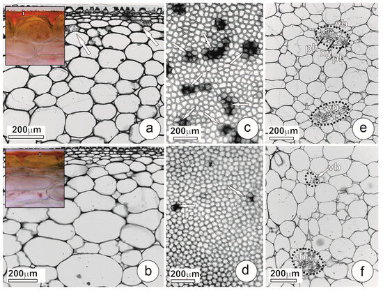 Vascular Tissues Distribution Affects Calcium and Calcium Oxalate ...