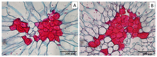 Does Regulated Deficit Irrigation Affect Pear Fruit Texture by ...