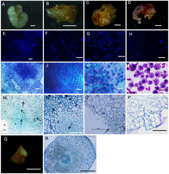 Regenerating Saffron (Crocus sativus L.) from Corm Lateral Buds via ...