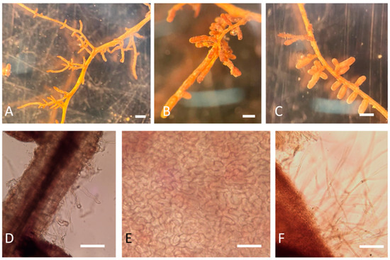 Effect of Bacteria Inoculation on Colonization of Roots by Tuber ...