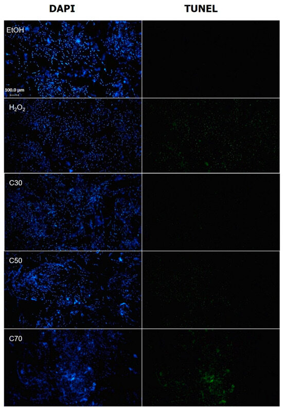 Antifungal Activity of Cedrol from Cunninghamia lanceolate var ...