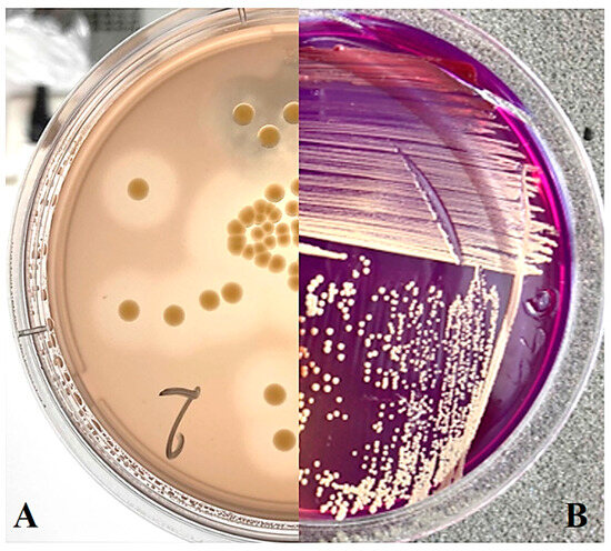 Phytopathogenic Curtobacterium flaccumfaciens Strains Circulating on ...