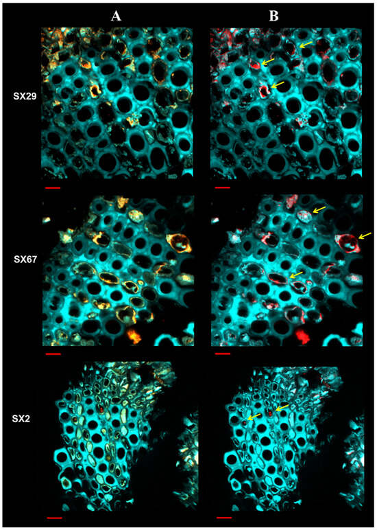 The Significance of Xylem Structure and Its Chemical Components in ...
