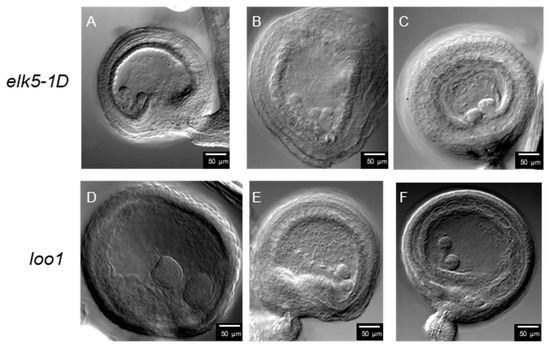 Twin Embryos in Arabidopsis thaliana KATANIN 1 Mutants