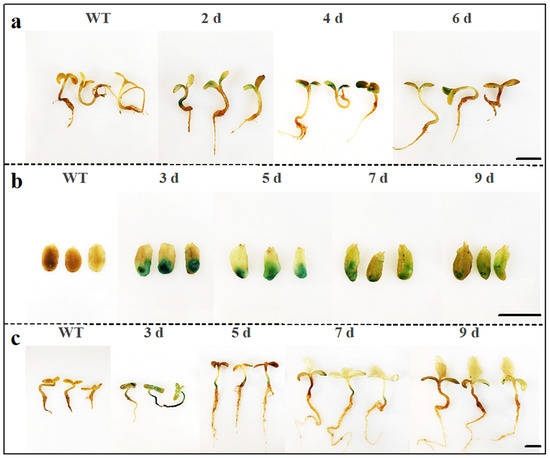 Establishment of Agrobacterium-Mediated Transient Transformation System ...