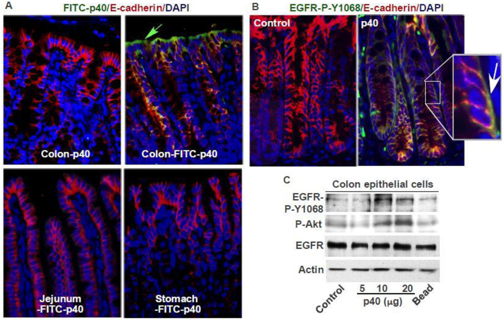 Hydrogels from Biopolymer Hybrid for Biomedical, Food, and Functional ...