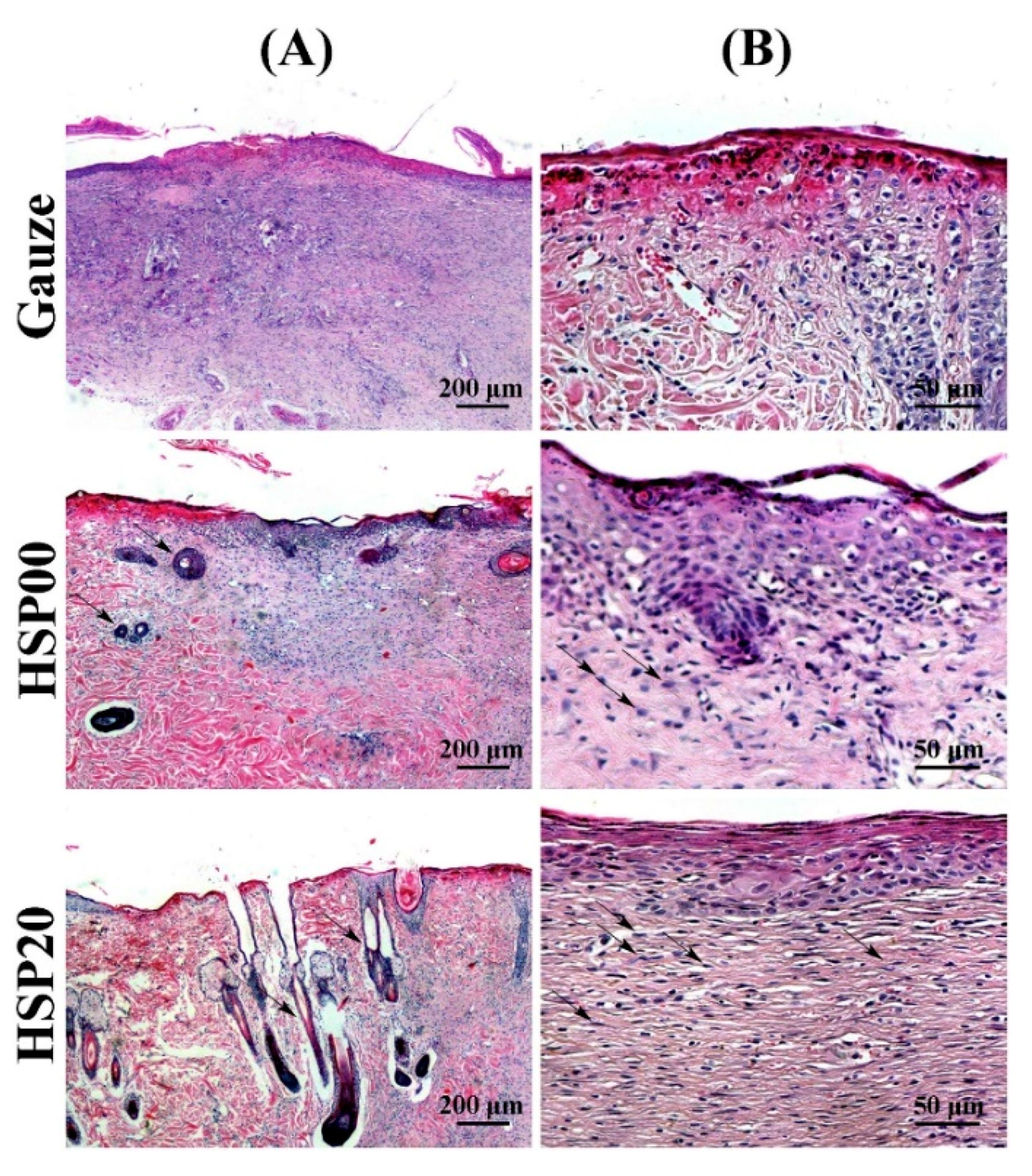 Recent Overviews in Functional Polymer Composites for Biomedical ...
