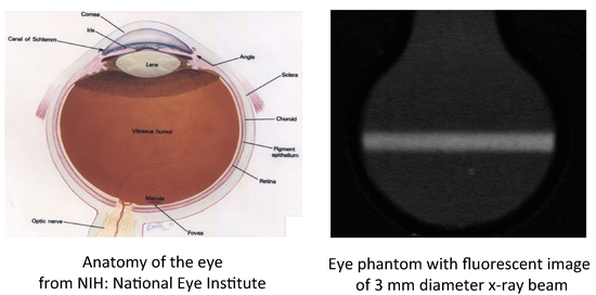 Polymers | Free Full-Text | A Polymer-Gel Eye-Phantom for 3D ...