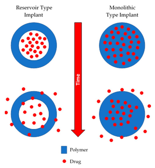 Implantable Polymeric Drug Delivery Devices: Classification ...