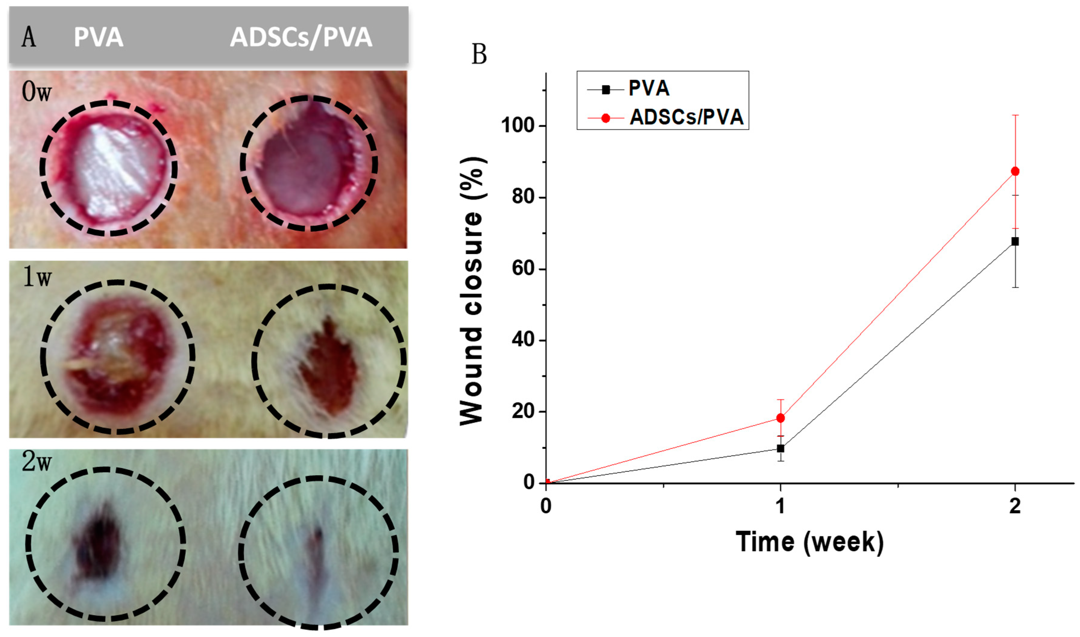 Patterned Polyvinyl Alcohol Hydrogel Dressings with Stem Cells Seeded ...