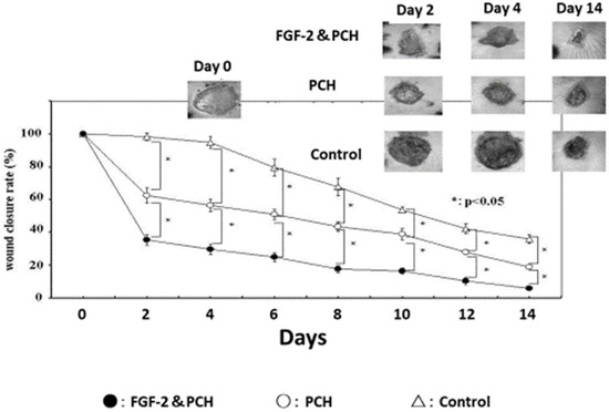 Polyelectrolyte Complexes of Natural Polymers and Their Biomedical ...