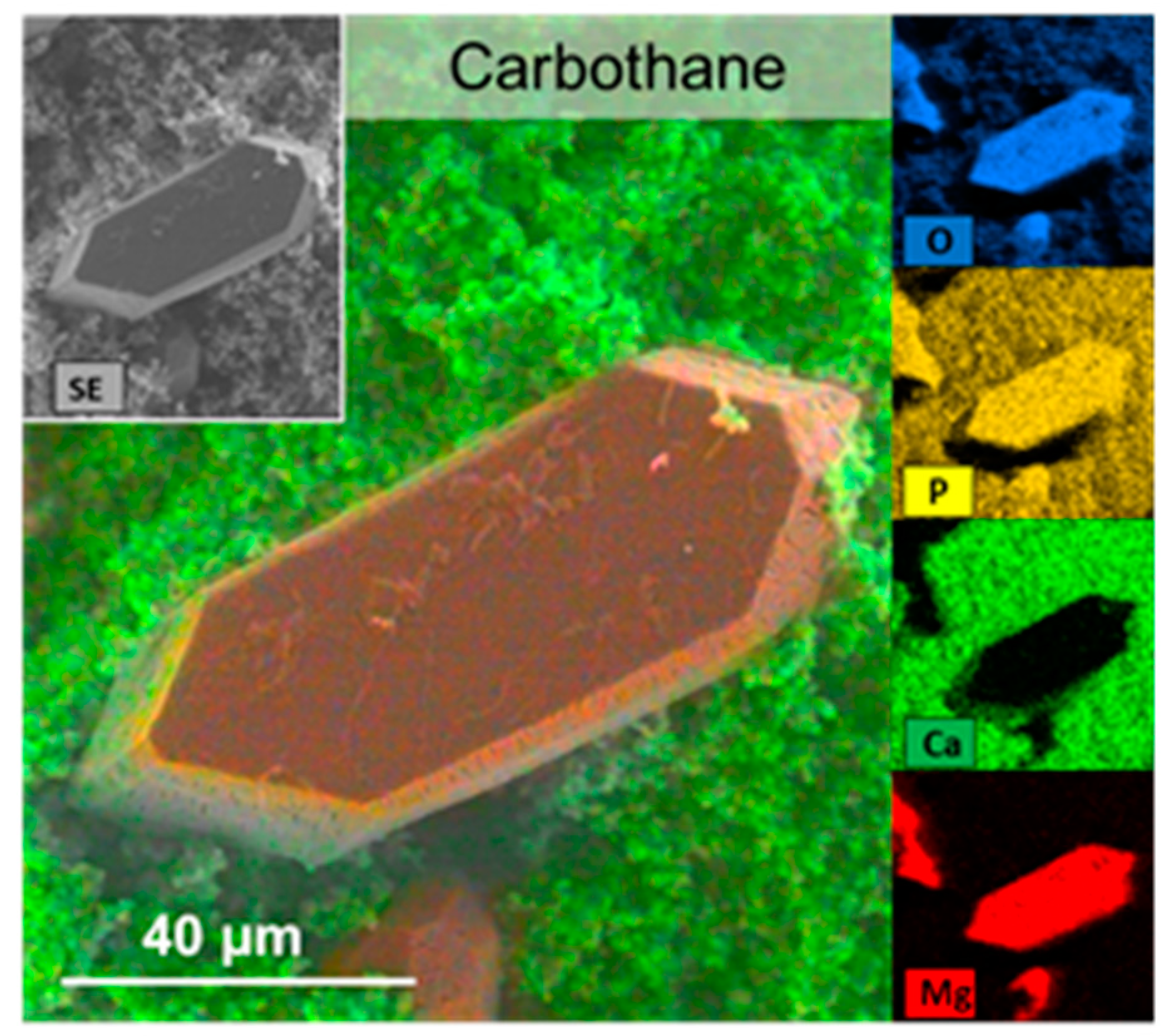 Prevention of Encrustation on Ureteral Stents: Which Surface Parameters ...