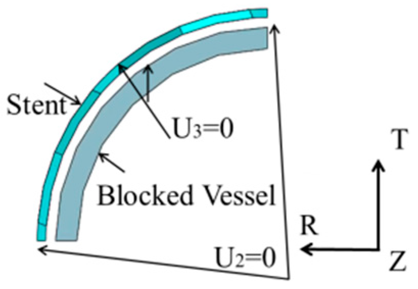Theoretical and Numerical Analysis of Mechanical Behaviors of a Metamaterial-Based Shape Memory ...
