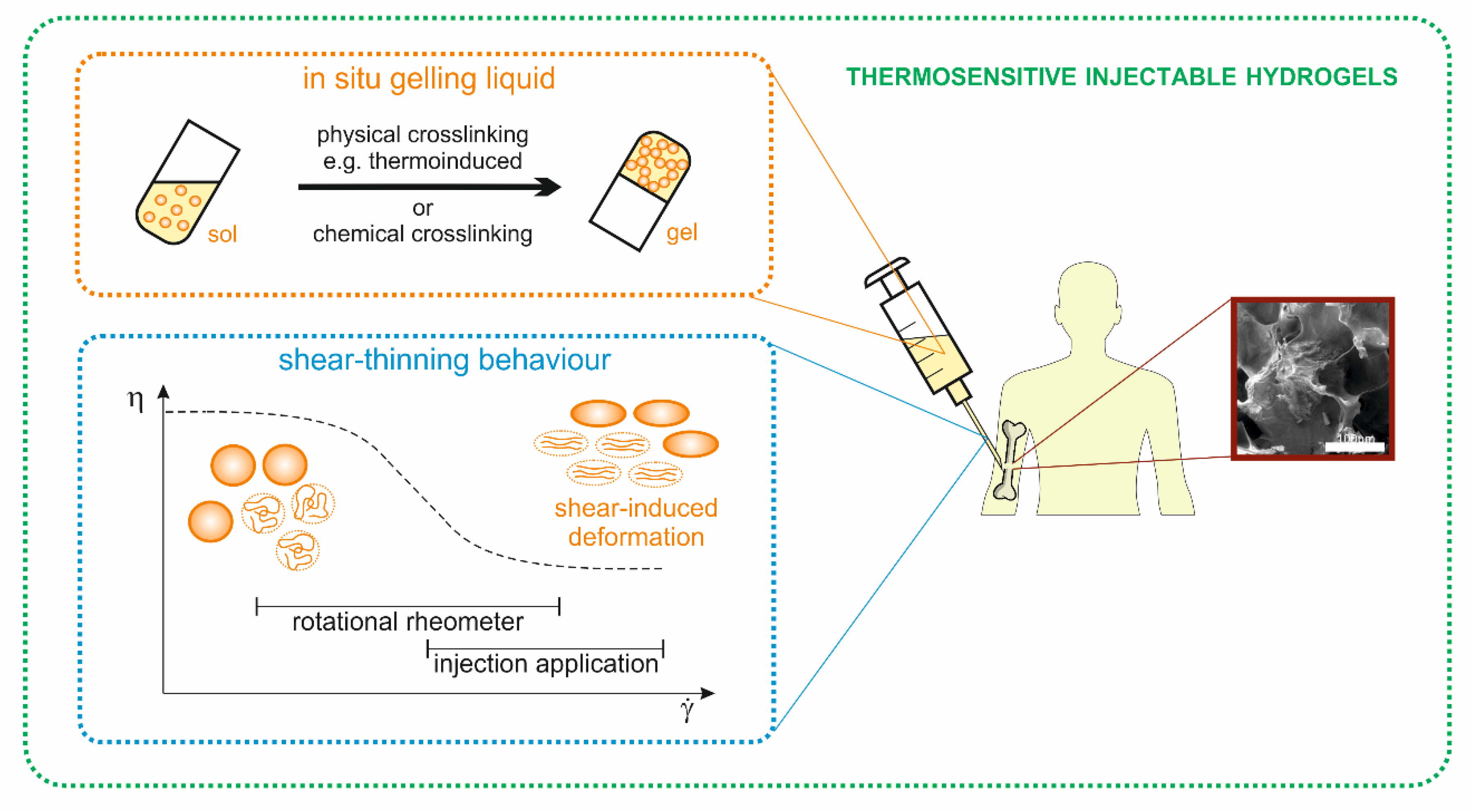 Injectability of Thermosensitive, Low-Concentrated Chitosan Colloids as ...