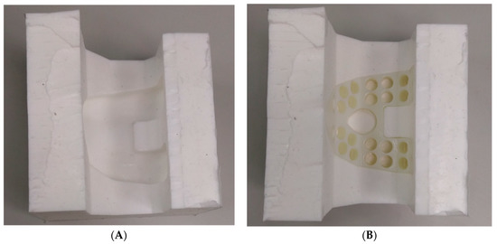 Polyethylene-Based Knee Spacer for Infection Control: Design Concept ...