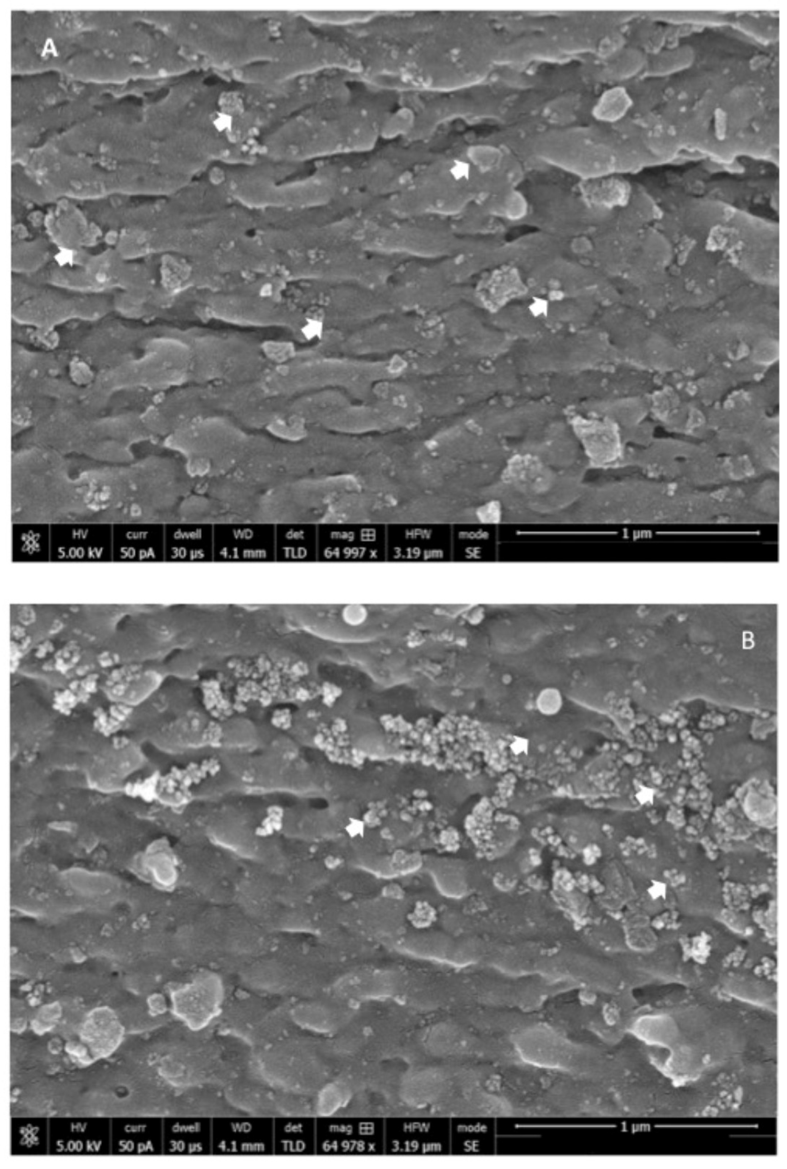 Influence of Hydroxyapatite Nanospheres in Dentin Adhesive on the ...