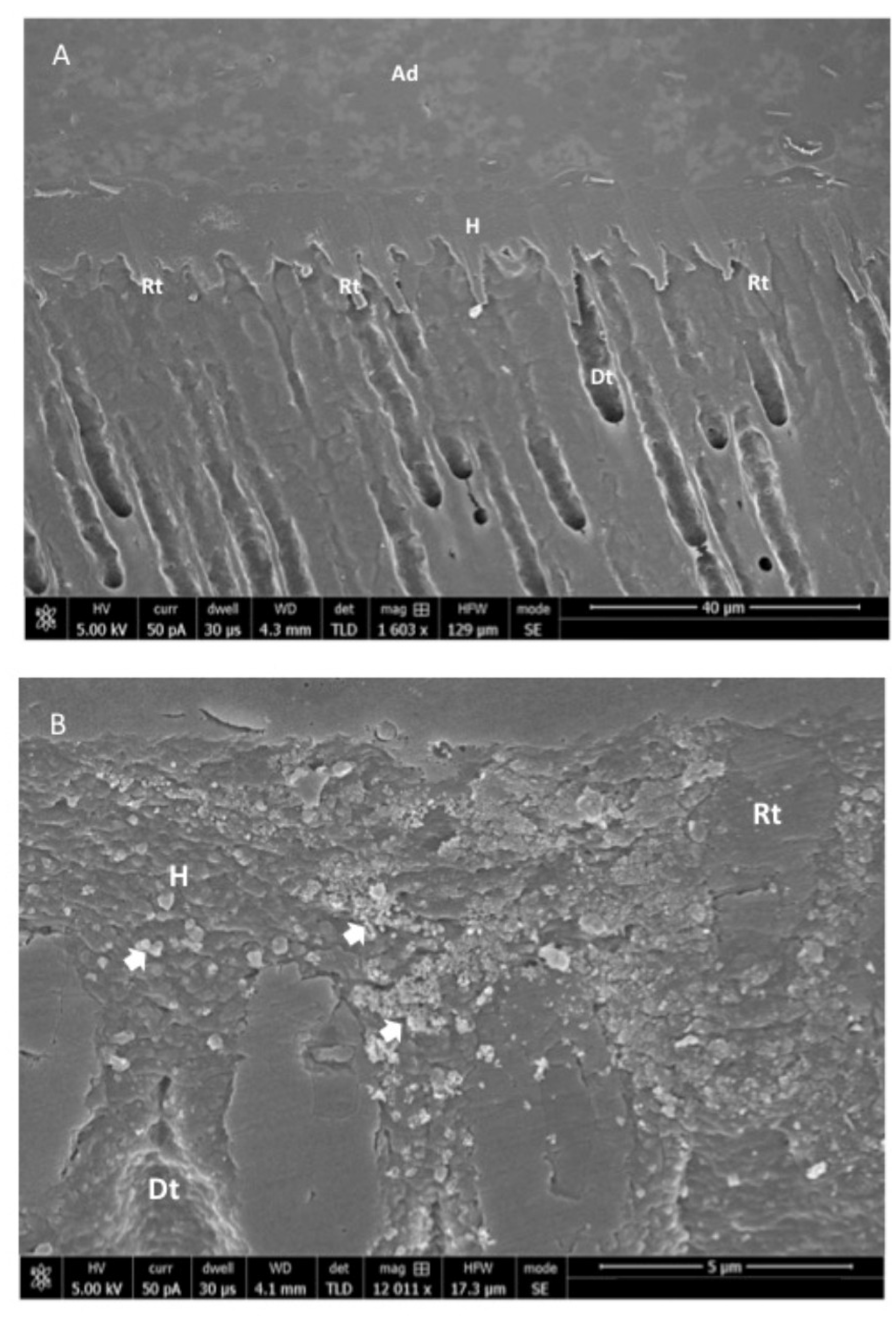Influence of Hydroxyapatite Nanospheres in Dentin Adhesive on the ...