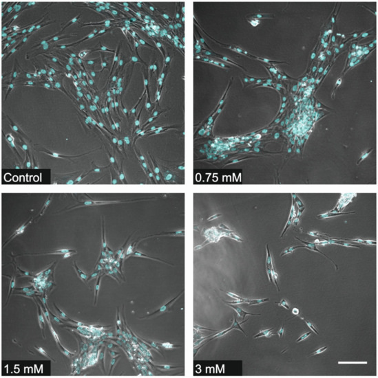 TEGDMA (Triethylene Glycol Dimethacrylate) Induces Both Caspase ...