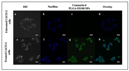 Garcinol Encapsulated Ph-Sensitive Biodegradable Nanoparticles: A Novel ...