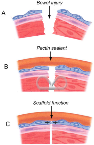 Biomaterial-Assisted Anastomotic Healing: Serosal Adhesion of Pectin Films