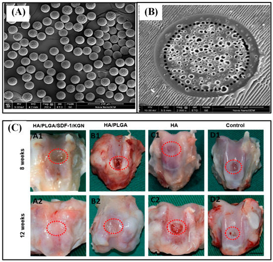 PLGA Core-Shell Nano/Microparticle Delivery System for Biomedical ...