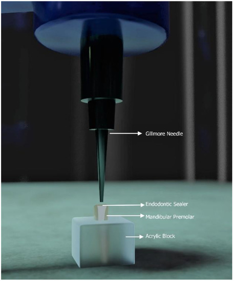 Influence of Commonly Used Endodontic Irrigants on the Setting Time and ...