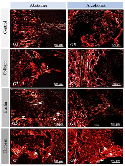 In Vivo Study of Nasal Bone Reconstruction with Collagen, Elastin and ...