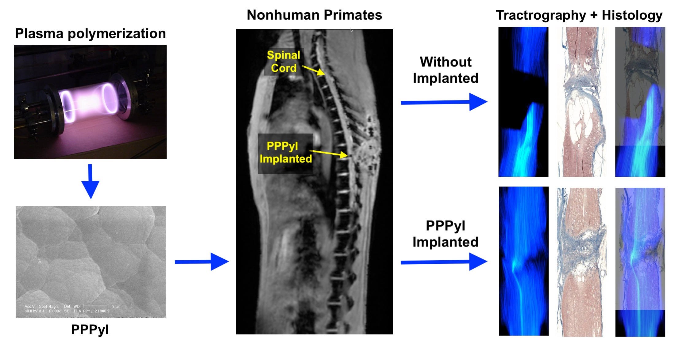 Polymers | Free Full-Text | Evolution of Spinal Cord Transection of ...