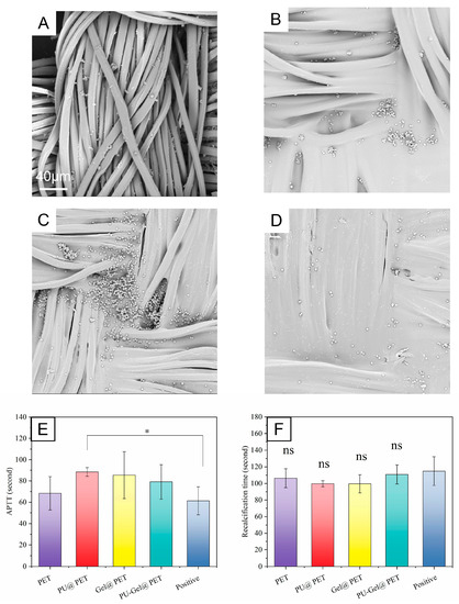 Improving Biocompatibility of Polyester Fabrics through Polyurethane ...