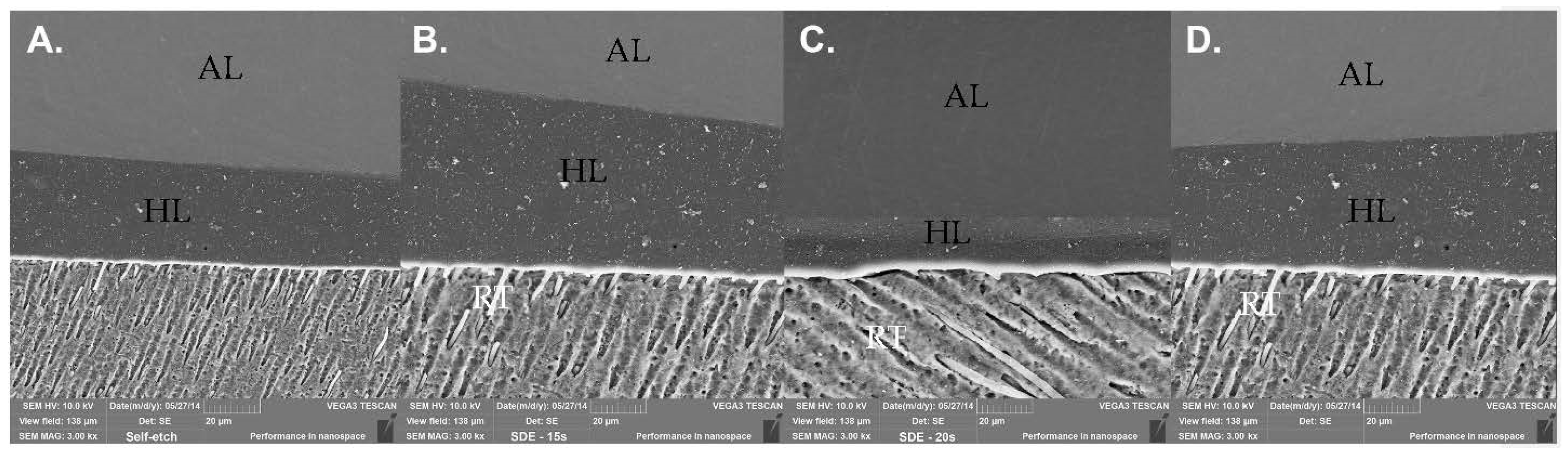 Effect of Active Bonding Application after Selective Dentin Etching on ...