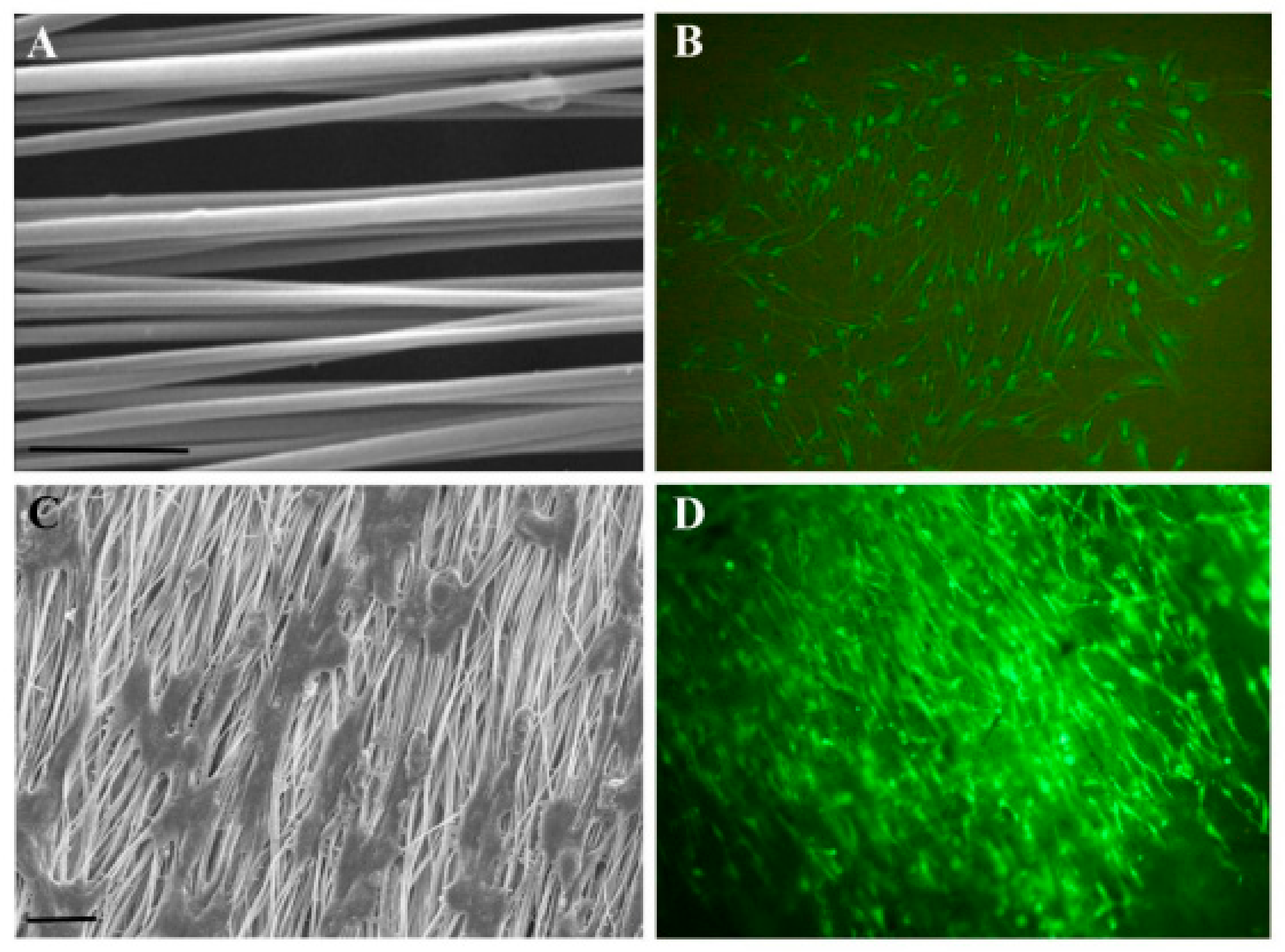 Poly-l-Lactic Acid (PLLA)-Based Biomaterials for Regenerative Medicine ...