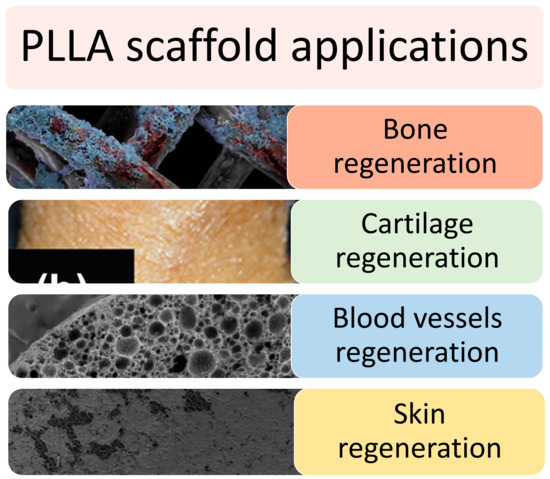 Poly-l-Lactic Acid (PLLA)-Based Biomaterials for Regenerative Medicine ...
