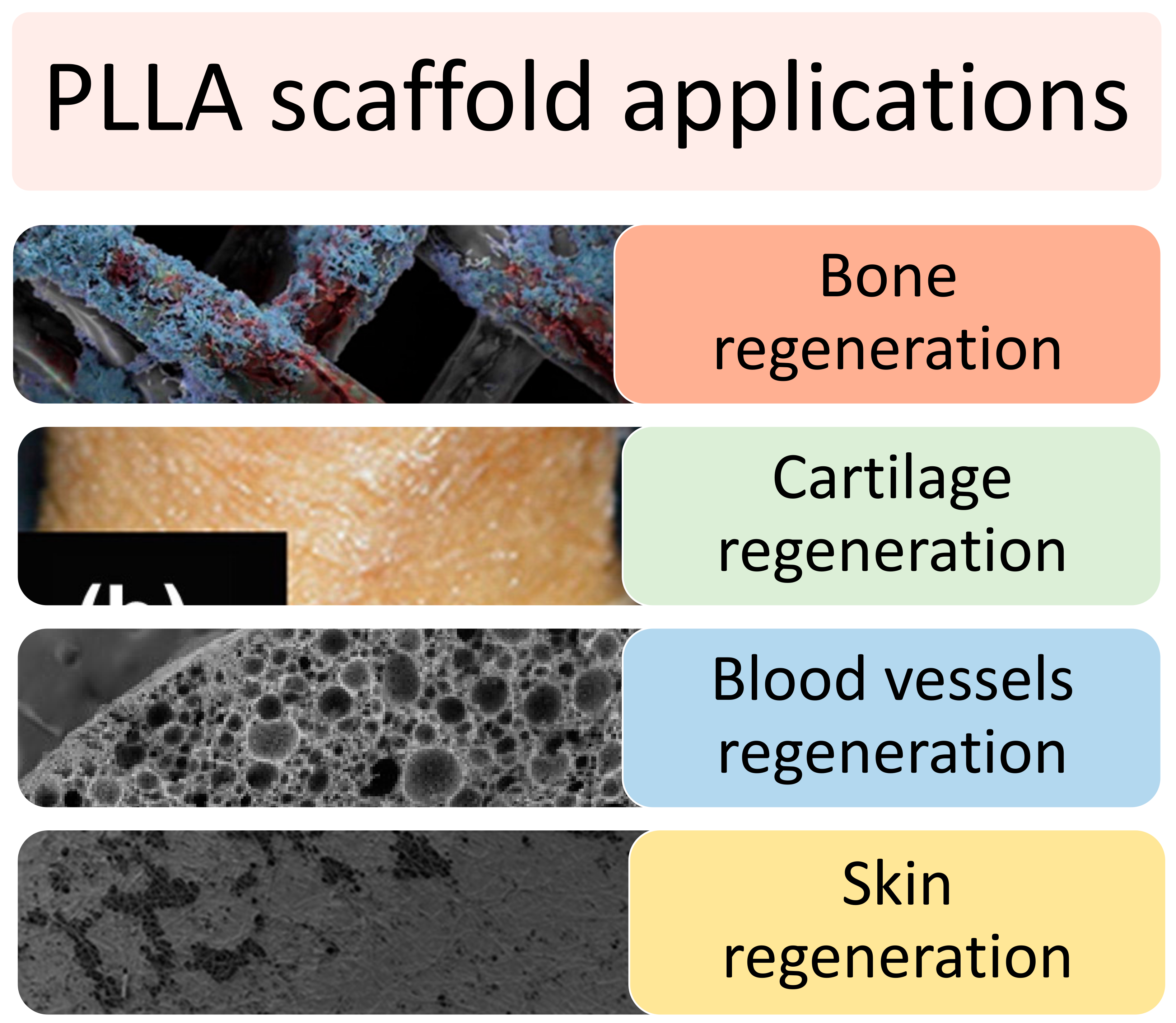 Poly-l-Lactic Acid (PLLA)-Based Biomaterials for Regenerative Medicine ...