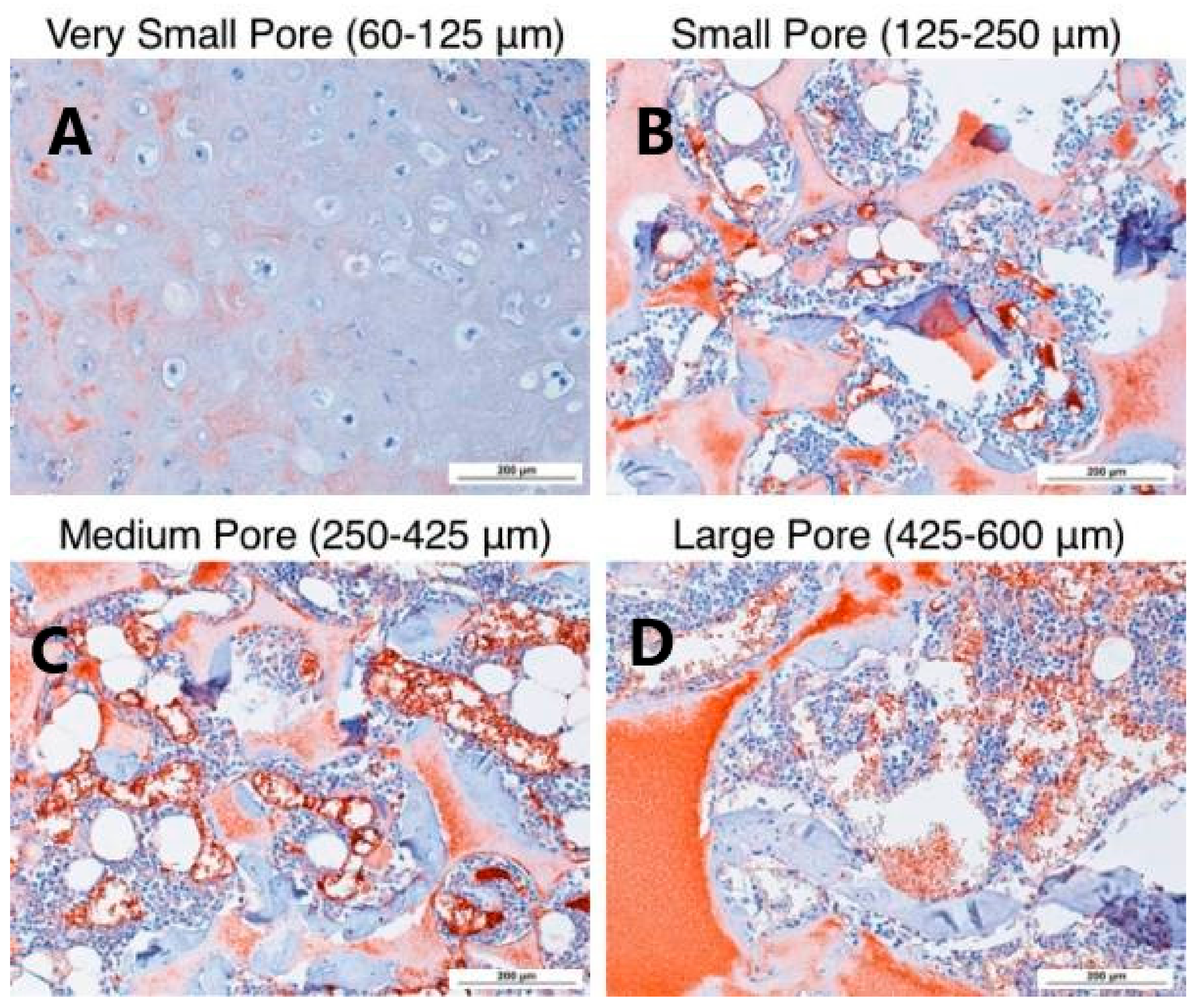 Poly-l-Lactic Acid (PLLA)-Based Biomaterials for Regenerative Medicine ...